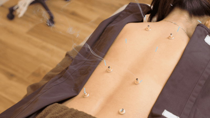 Hiroshima: Acupuncture and Japanese Unique Massage Treatment - Seitai: Japanese-Style Chiropractic